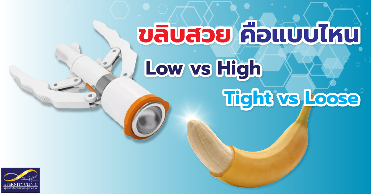 ขลิบสวย คือแบบไหน Low vs High , Tight vs Loose - eternityclinicdoctorbeer